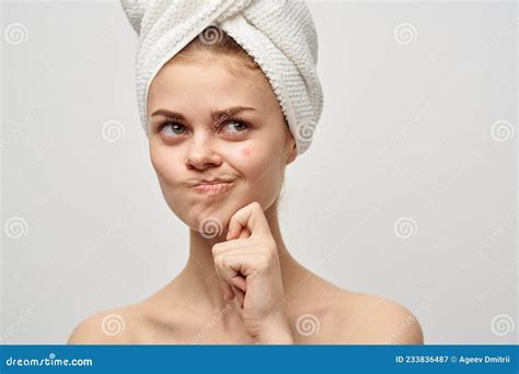 Woman With A Pimple On The Face Skin Problems Close Up Stock Image Image Of Hair Female