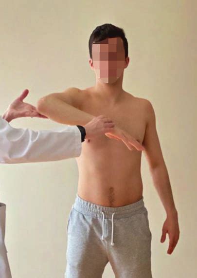 9 Hawkins Kennedy Impingement Test Download Scientific Diagram