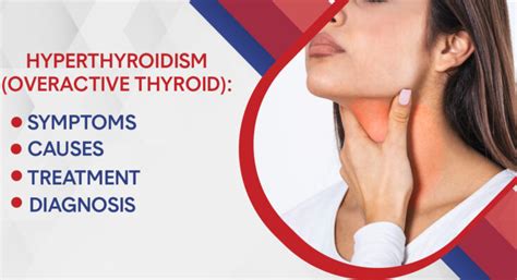 Hyperthyroidism Diagnosis And Treatment