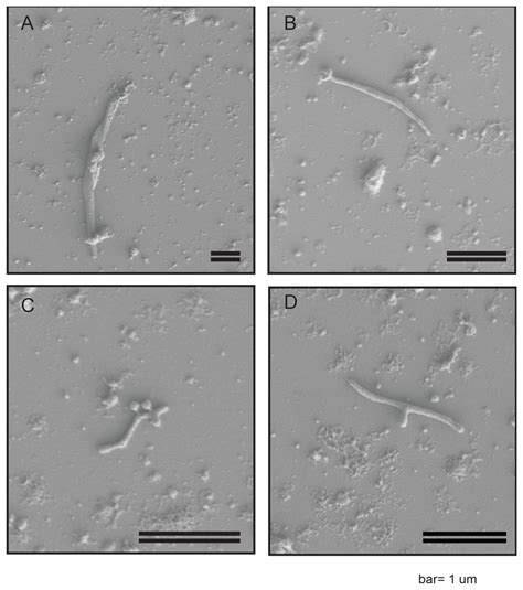 Genome Resolved Insights Into A Novel Spiroplasma Symbiont Of The Wheat