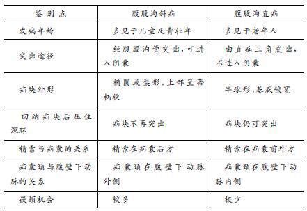 如何区分腹股沟斜疝与腹股沟直疝 再造人