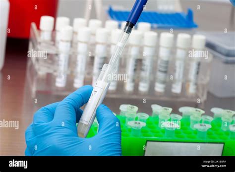Closeup Of A Scientist Extracting Dna Using The Spin Column Based Nucleic Acid Purification