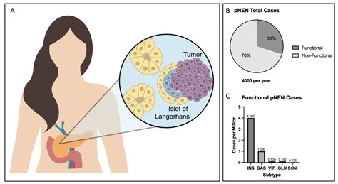 Models In Pancreatic Neuroendocrine Neoplasms Current Perspectives And Future Directions