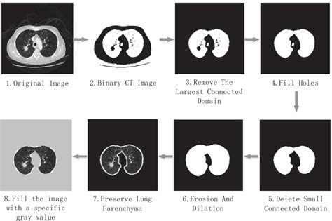 The Process Of Segmenting Lung Parenchyma From Ct Images Download