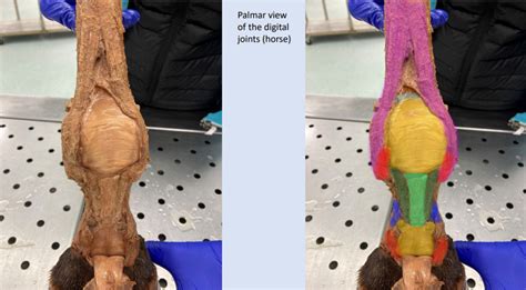 Diagram Of Proximal Interphalangeal Joint PIP Quizlet