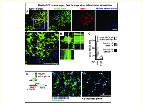 Endogenous Neural Precursor Cells Accumulate At Experimental Brain