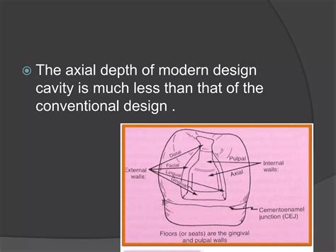 Modifications Of Class 2 Cavity Preparations Pptx Oral Care Personal Care