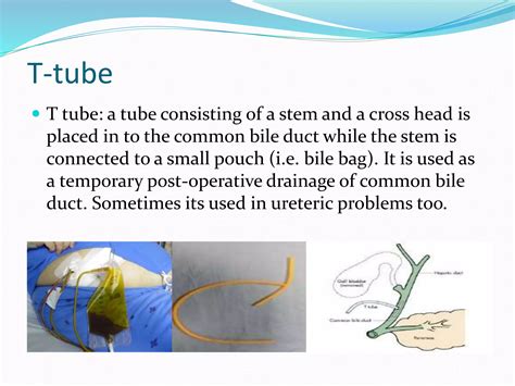 Surgical Drains Pptx