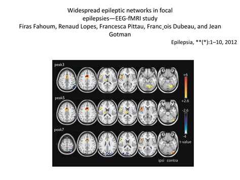 Ppt Multi Modal Imaging Simultaneous Eeg Fmri Powerpoint