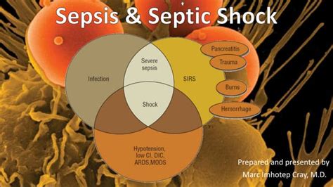 Sepsis Cascade Diagram