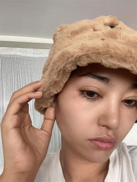 មិនចង់ជឿ ដោយសារជំងឺនេះ អេង វ៉ាណង ជ្រុះសក់អស់ Khmerload Cambodia Latest News