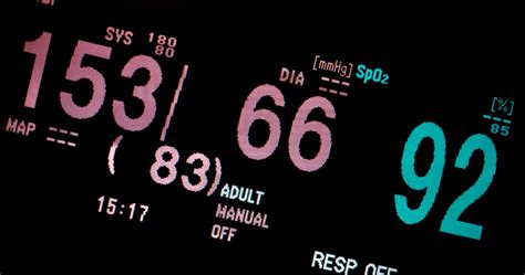 หน่วยวัดแรงดัน