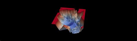 L1 And L2 Regularization Plus Dropout By Juan Vera Medium