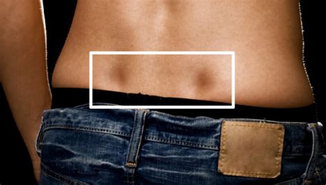 If You Have These Two ‘dimples On Your Lower Back This Is What They Mean
