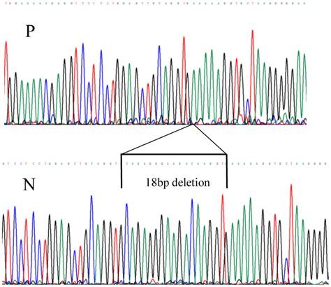 Allele Specific Rt‐pcr Sequence Obtained From Rt‐pcr Amplified Cdna Download Scientific Diagram