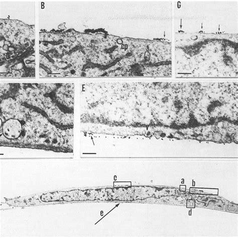 Conventional Transmission Electron Micrograph Of An A1 F Human Skin Download Scientific Diagram