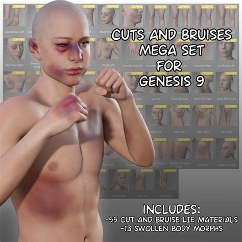 Cuts And Bruises Mega Set For Genesis 9 2026 Free Daz 3d Models