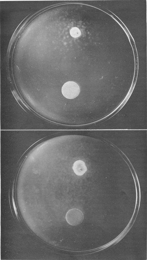 Top Interaction Between Borrelia Vincentii And A Microaerophilic