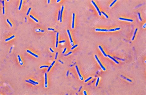 Clostridium Botulinum Stock Image B220 1552 Science Photo Library