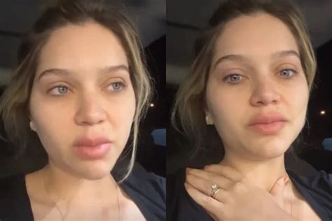 Lyandra Costa Sofre Acidente Doméstico E Deixa Fãs Preocupados Portal Área Vip