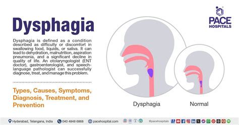 Dysphagia Symptoms Causes Diagnosis And Treatment