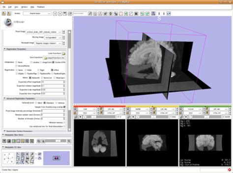 Itk Registration Optimization Namic Wiki