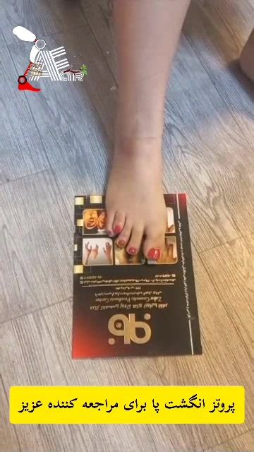 پروتز انگشت پا