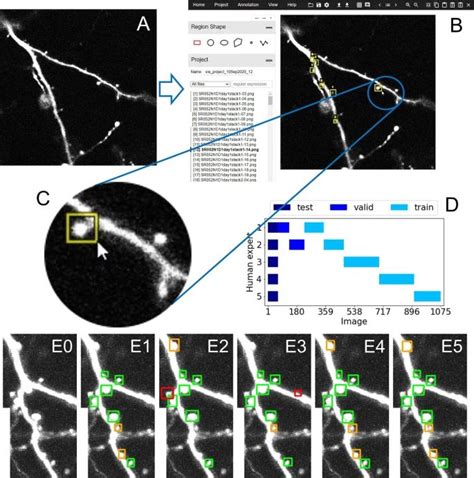 Utilizing 2d Region Based Cnns For Automatic Dendritic Spine Detection In 3d Live Cell Imaging