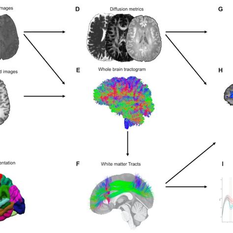 Mri Processing Pipeline A And B Raw Diffusion Weighted And Download Scientific Diagram