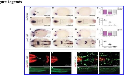 Figure 1 From Glis3 As A Critical Regulator Of Thyroid Primordium