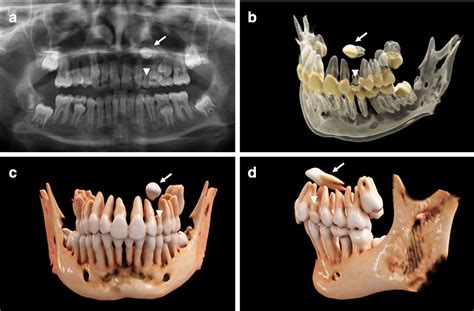 Cinematic Rendering To Visualize Teeth Segmentation