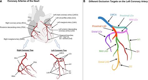 Frontiers Current Status And Limitations Of Myocardial Infarction