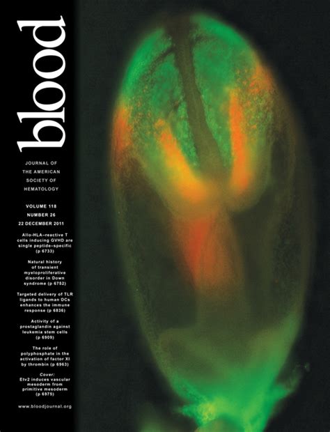 Asxl1 Mutations Identify A High Risk Subgroup Of Older Patients With