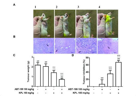 The Effect Of Kpl Combined Abt 199 On Tumour Growth And Tumour Cells