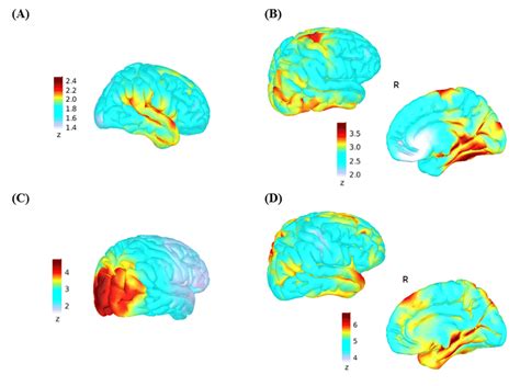 Source Estimation For EEG Activity In Response To The Oddball A B Download Scientific
