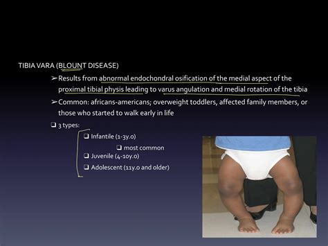 36 Bones And Joints Disorder Pediatrics Pdf