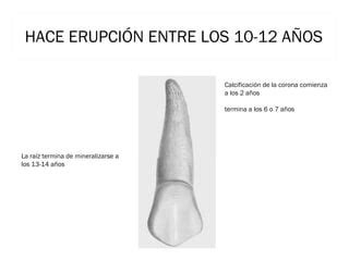 Segundo Premolar Superior Ppt