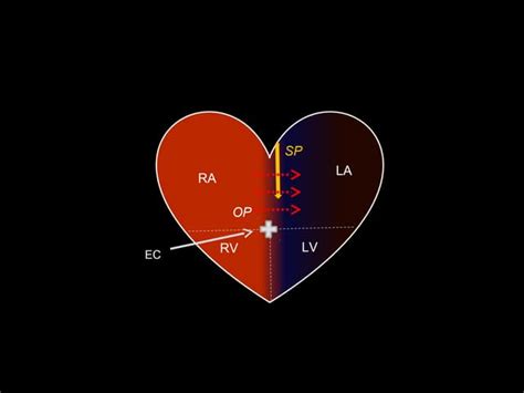 Animations Only 5 Ppt