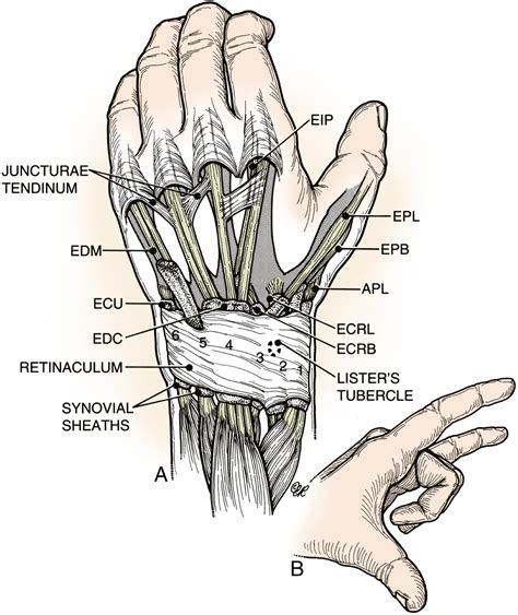 Extensor Tendon Injury Clinical Tree