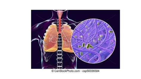 Gram Negative Rodspdf