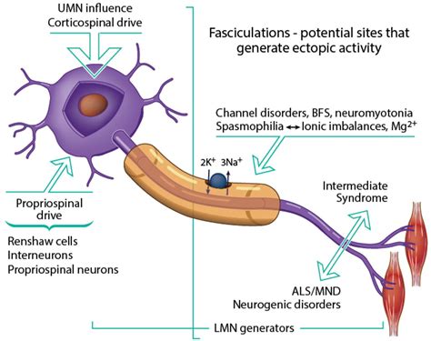 Benign Fasciculation Syndrome Mimics And Chameleons In Motor Neurone