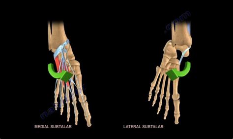 Subtalar Dislocation —