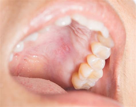 What To Do When You Throw Up In Your Mouth At Michele Kurtz Blog