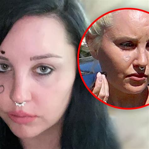 Amanda Bynes Face Tattoo Removal