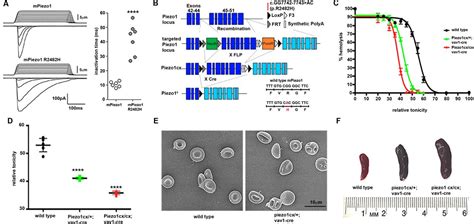 Xerocytosis Hereditary Xerocytosis Spectrum And Clinical