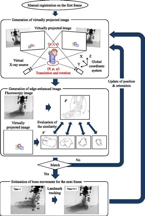 Direct Assessment Of 3d Foot Bone Kinematics Using Biplanar X Ray Fluoroscopy And An Automatic