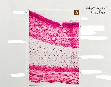 Trachea Microscopic Anatomy Quiz