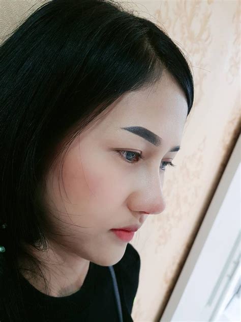 ทรงสโลปปลายพุ่งสวยมากๆจ้า มาตัดไหมแล้ว ครบ 14 วัน หลังหู 2 ชั้น คุณหมอวี ⬇️ 🔴 เหลาพรีเมี่ยม