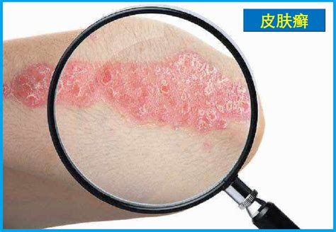 皮肤、指甲与头发 生命周期健康 法道营养草本网站