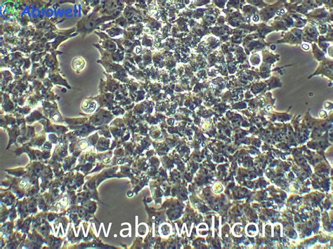 Sk N Mc 人神经上皮瘤细胞艾碧维生物官网